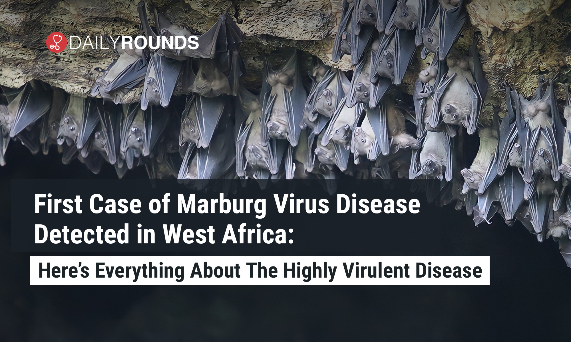 First Case of Marburg Virus Disease Detected in West Africa: Here’s Everything About The Highly ...