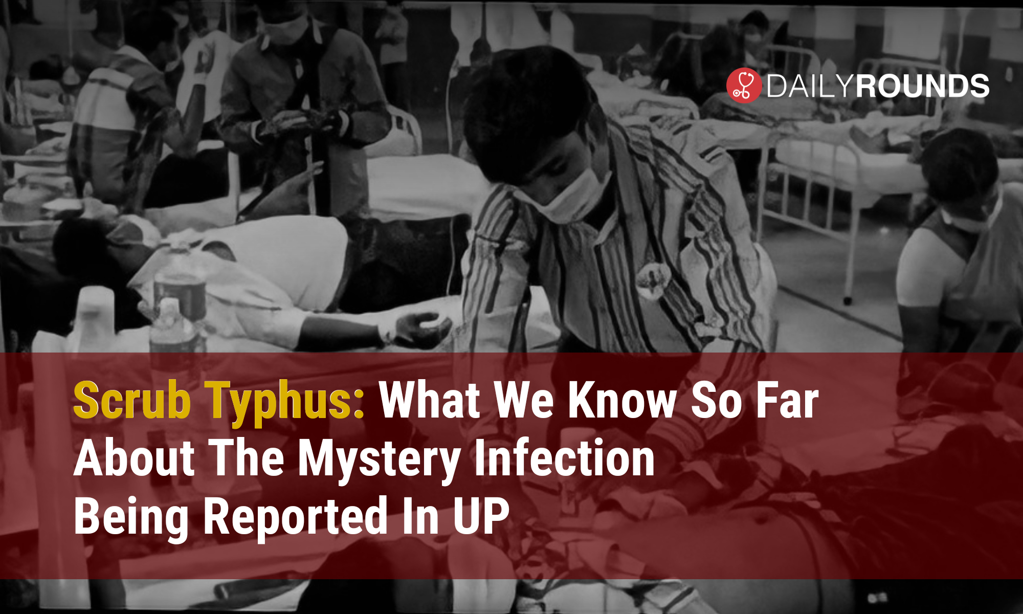 Scrub Typhus: What We Know So Far About The Mystery Infection Being ...